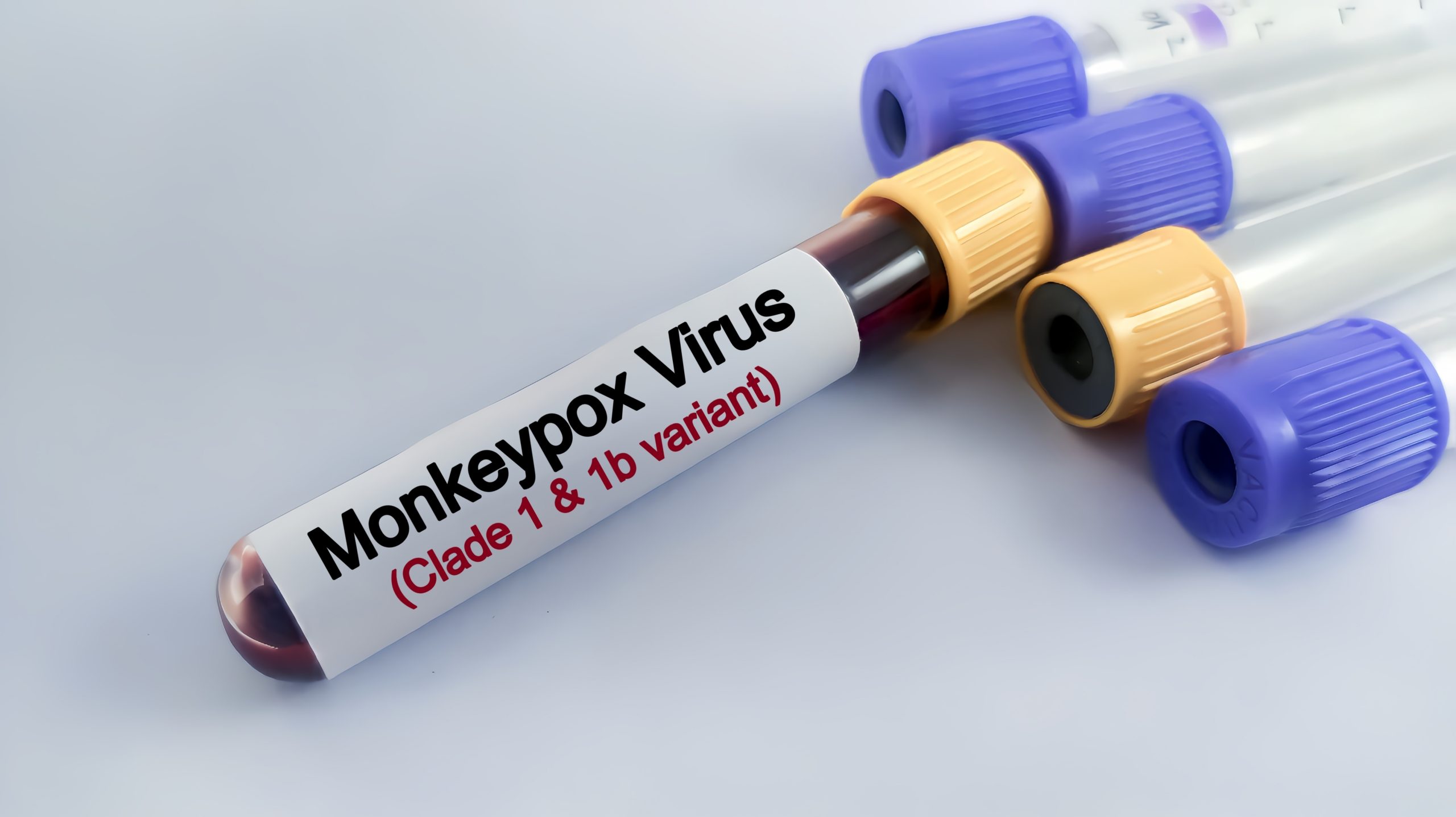 Mpox en Afrique : les variants, ce casse-tête des experts – Ouestaf.com